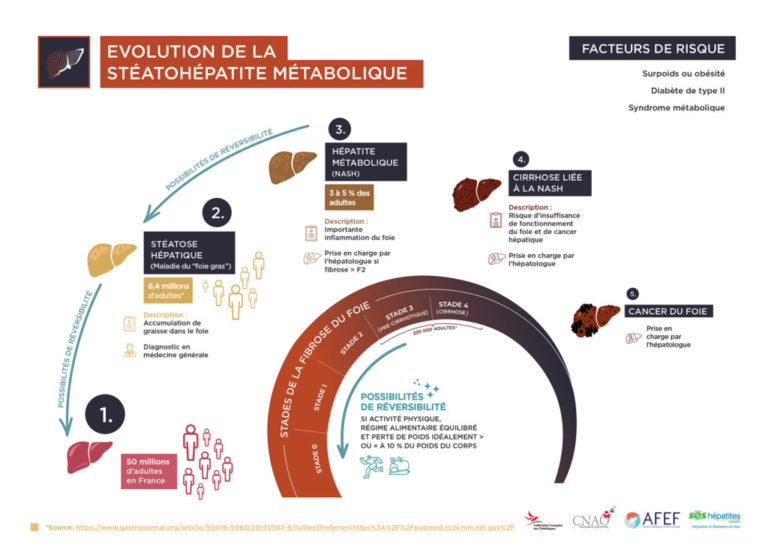 Stéatose et la stéato-hépatite - AFEF